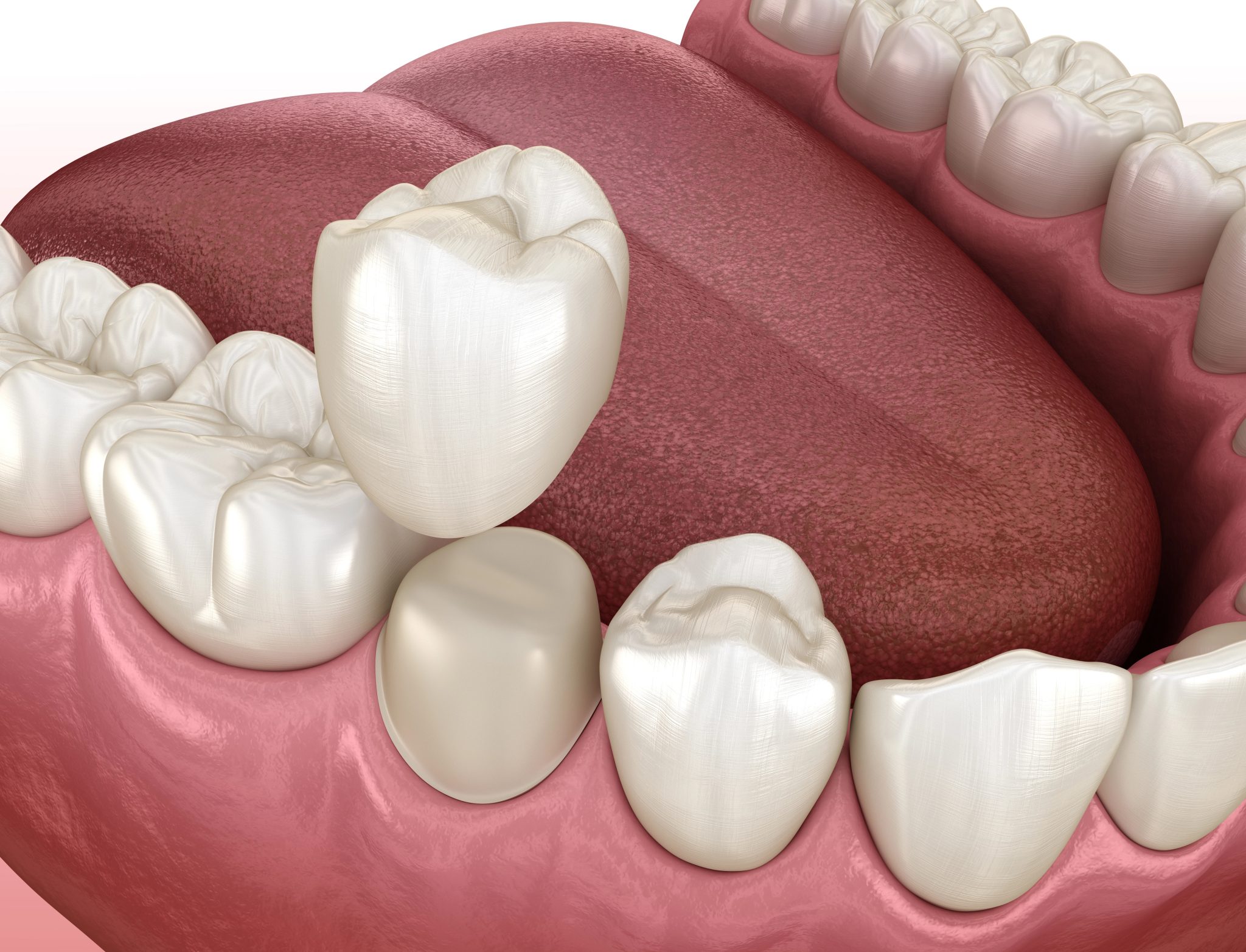 7 Types Of Restorative Dentistry Procedures | Dentist in Mandeville, LA